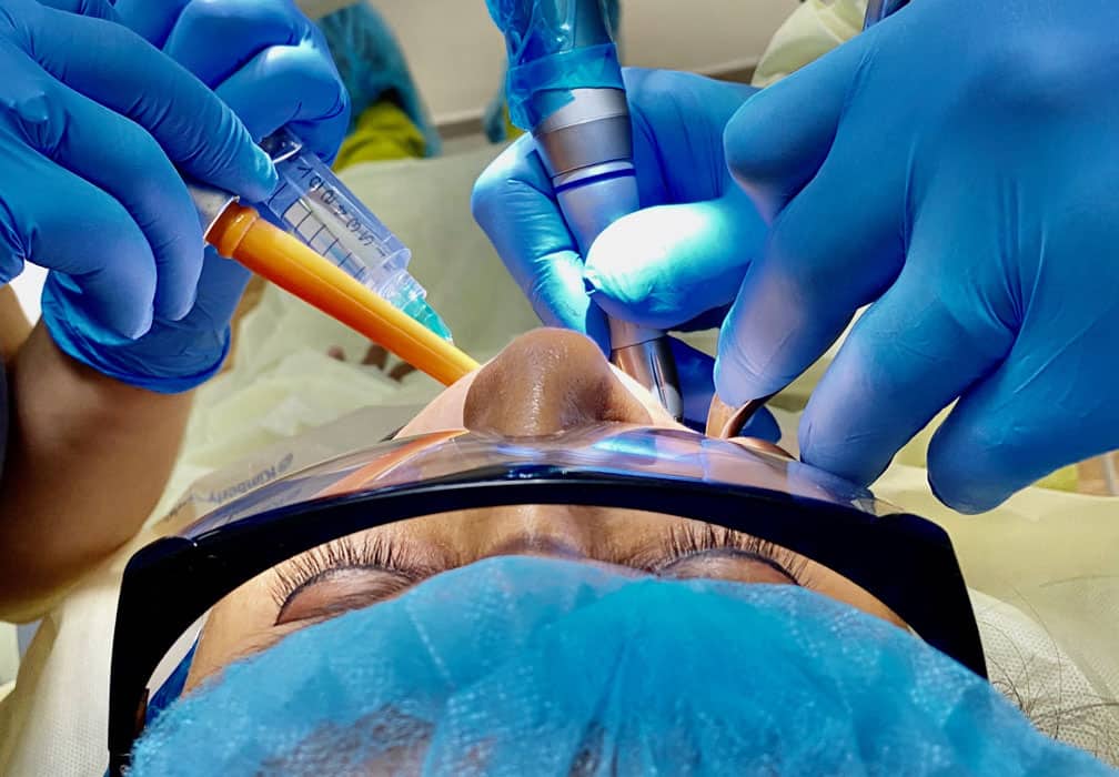 Announcing KCSI’s 5-Part Implantology Program - Koerner Center for ...